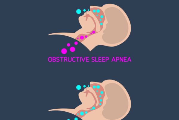 Vivos Sleep Apnea Treatment Laguna Niguel CA - Laguna Heights Dental